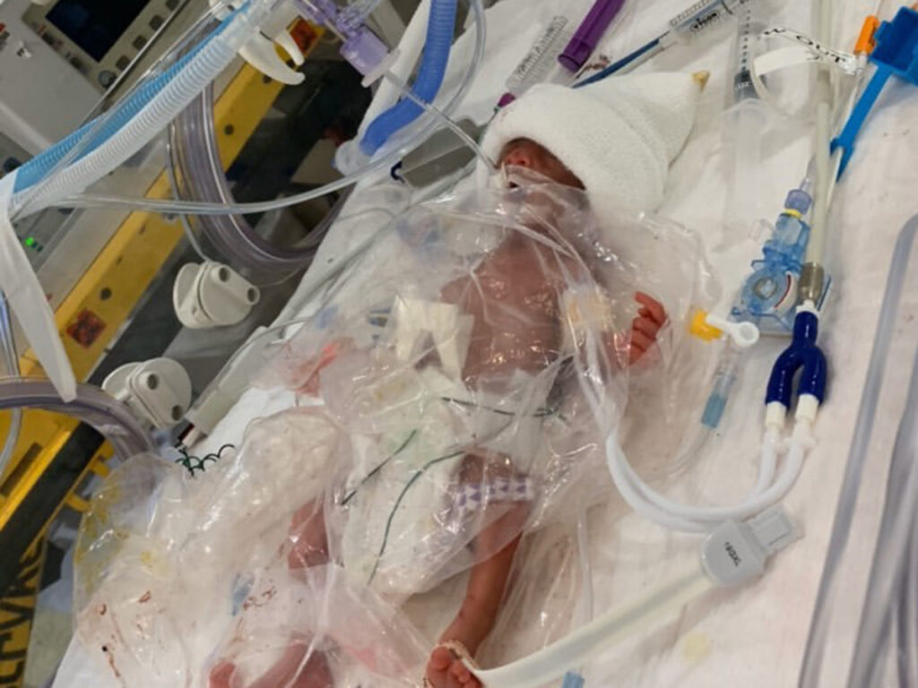 Meet the Vilela Family | ICU Baby